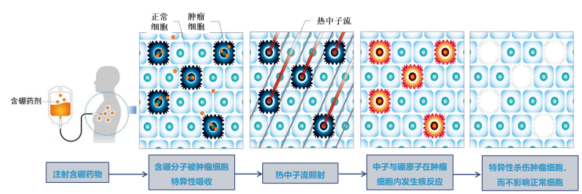 国产BNCT炸场！临床首治，肿瘤患者三天见疗效_东莞阳光网